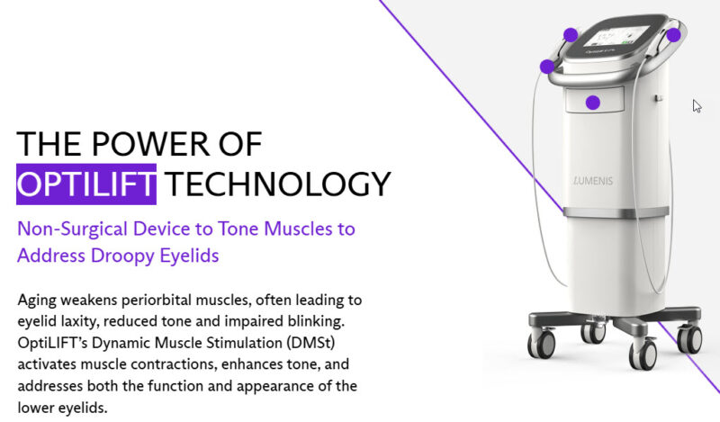 OptiLift – Atlee Gleaton Eye Care